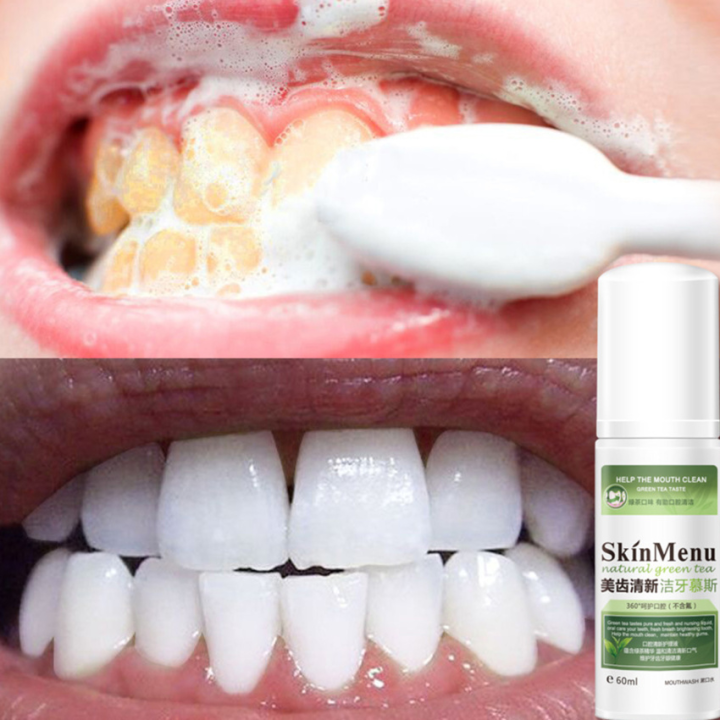 Teeth Cleansing Mousse Fresh Breath Oral Cavity Clean Nursing Foam ...