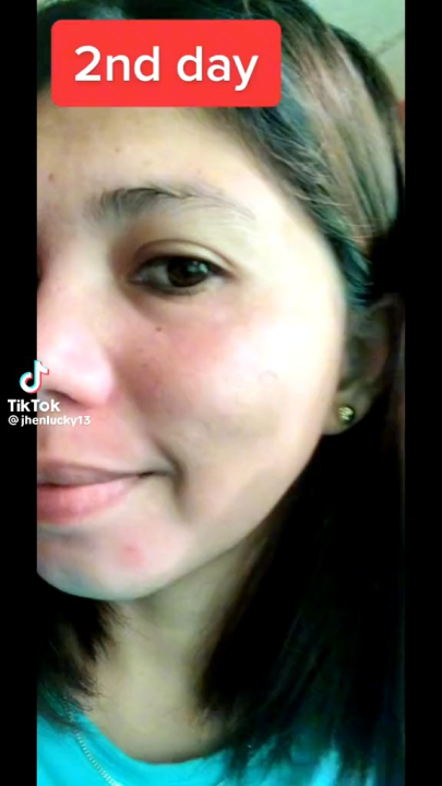 MELARASE CREAM With Freebies | Lazada PH