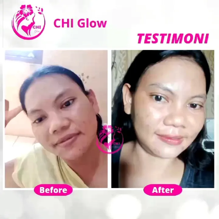 CHI GLOW OCHI EKONOMIS | Lazada Indonesia