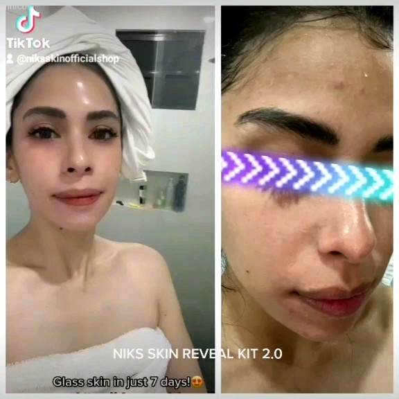 Niks Skin Reveal Kit New Look 2024 (Rejuvinating Kit)NIKS SKIN OFFICIAL ...