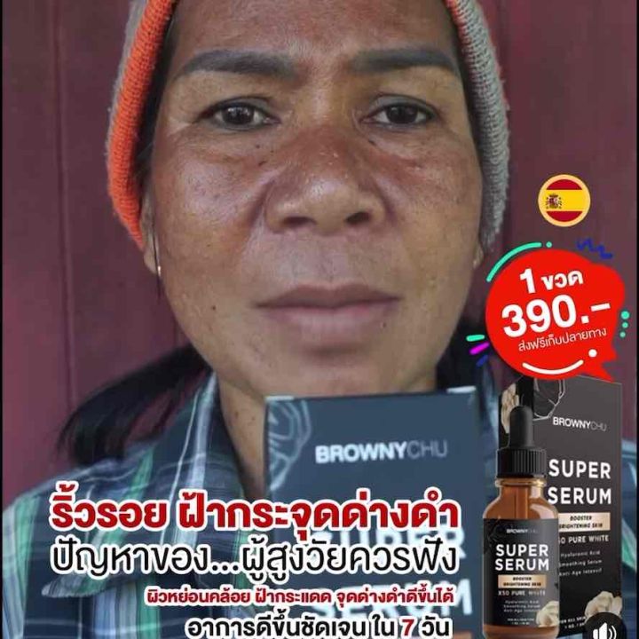 (พร้อมส่ง)แท้ 💯% ซุปเปอร์เซรั่ม BC BROWNYCHU SUPER SERUM เซรั่มที่ดีที่สุด เซรั่ม ฝ้า กระ สิว ...