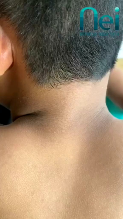 Nei Peeling Spray 100% Original Penghilang Daki Membersihkan Wajah Dan ...