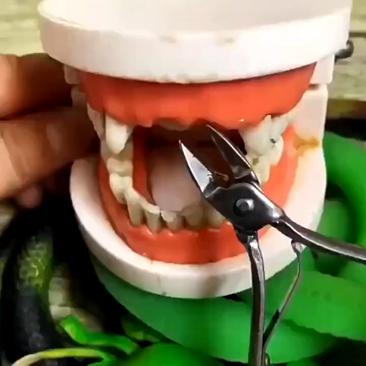 【Buy 1 Take 1】Moldable DIY Temporary Tooth Repair Kit Teeth And Gaps ...