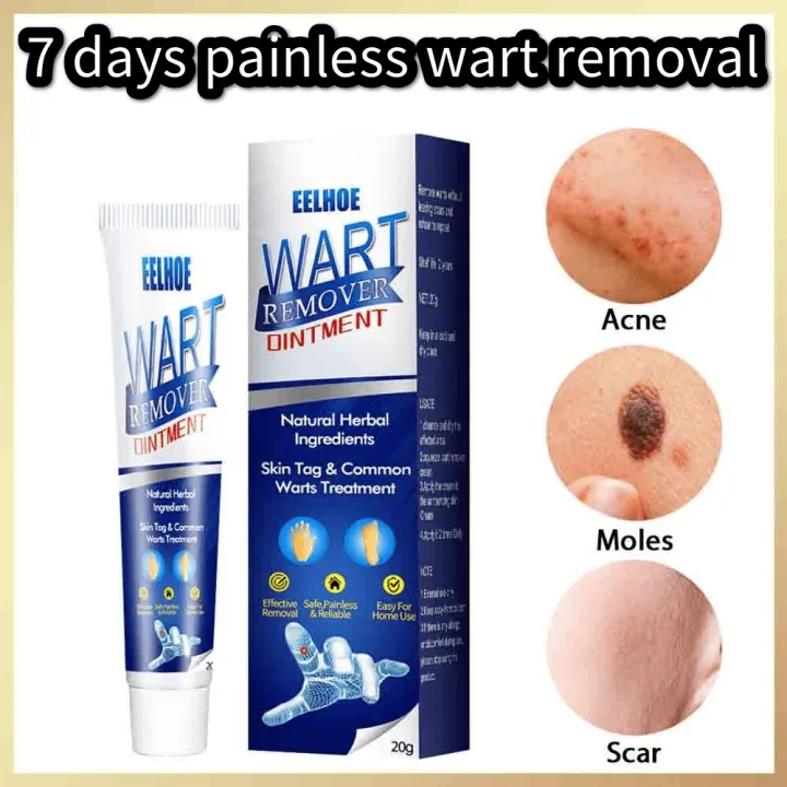 【7 days painless wart removal】Wart Removal Cream Body Warts Treatment ...