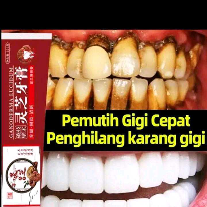 Pasta gigi Ganoderma lucidum perawatan gusi dan gigi goyang, Ampuh ...