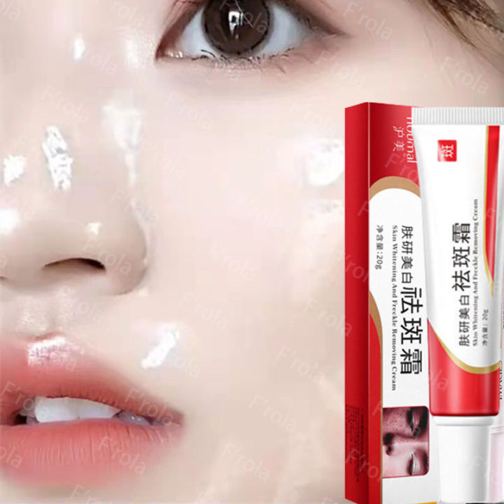 PEKAS REMOVER VERY EFFECTIVE Whitening & Freckle Remover Cream ...