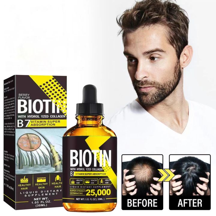 Vitamin B7 Hair Growth Essence Anti-hair loss Baldness Rapid ... Vitamin B7 Hair Growth Essence Anti-hair loss Baldness Rapid ...