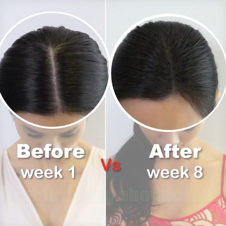 [SMIB] Anti Hair Loss shampoo 500ml / coral calcium / Hair Loss Care ...
