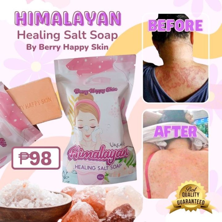 Himalayan Salt Soap by BerryHappySkin 135g Healing soap | Lazada PH