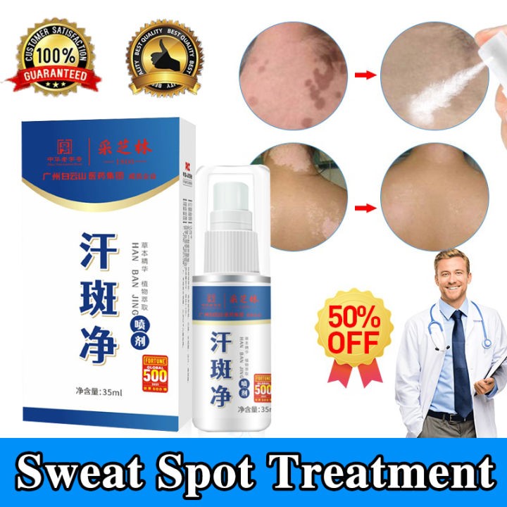 Sweat spot treatment spray 35ml vitiligo treatment cream Psoriasis ...