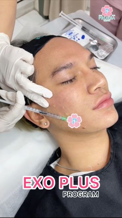 [E-Voucher] Pruksa Clinic Exo Plus Program เสริมสร้างคอลลาเจน ลดรอยแดง ผิวเรียบเนียน กระชับ และ ...