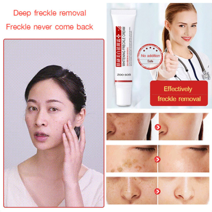 Whitening Anti-Freckle Moisturizing Cream Brightening Lighten Melanin ...