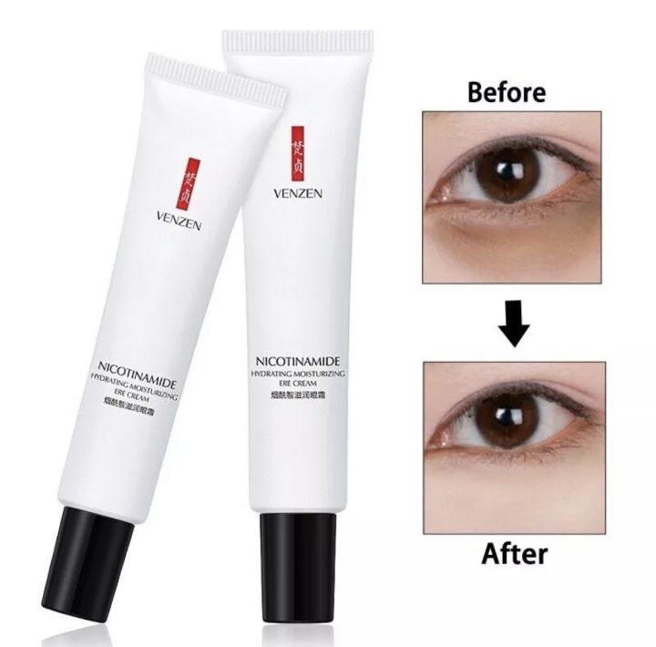ครีมทารอบดวงตา แบบหลอด Venzen ช่วยลดรอยคล้ำรอบดวงตา ช่วยลดเลือนริ้วรอย ...