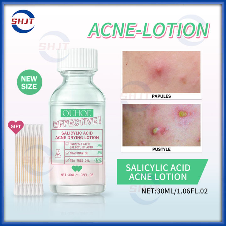 barenbliss BNB Pimple Warrior! Salicylic Acid Acne Drying Lotion - With ...