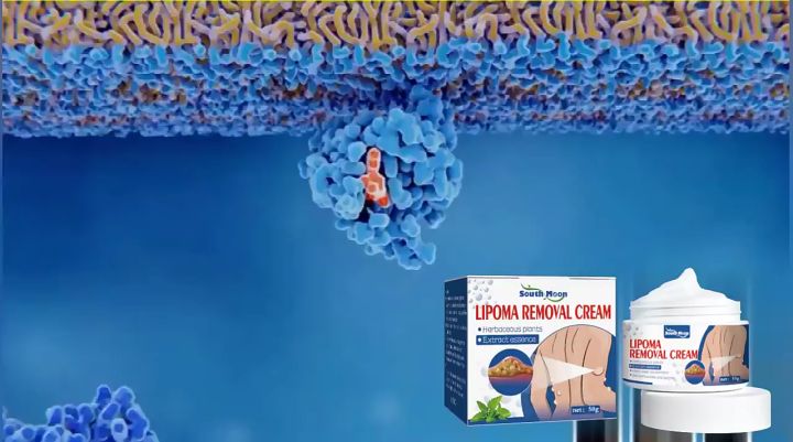 Lipoma Removal Cream Lipolysis Fat Lump Relieve Plaster Skin Swelling ...