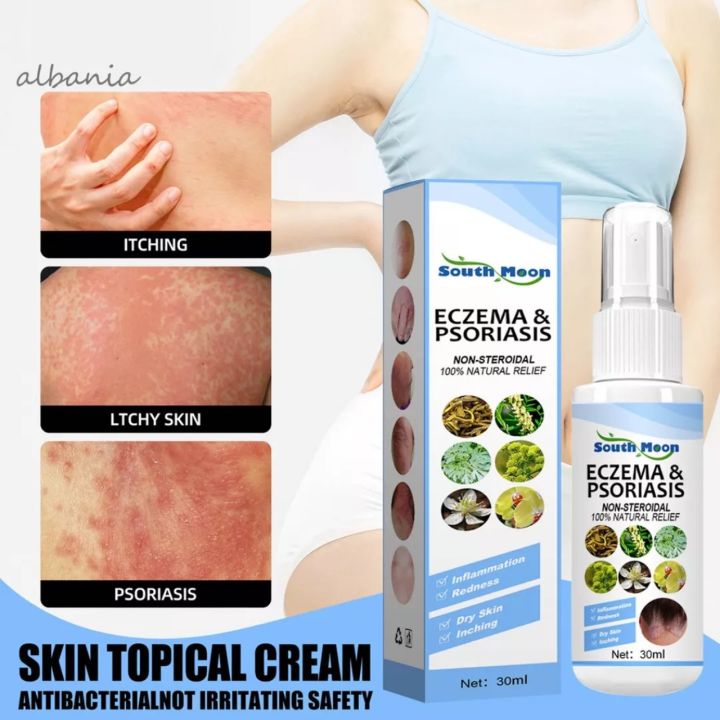 💯% Original Eczema Psoriasis Spray Treatment Gamot sa Kati kati sa ...