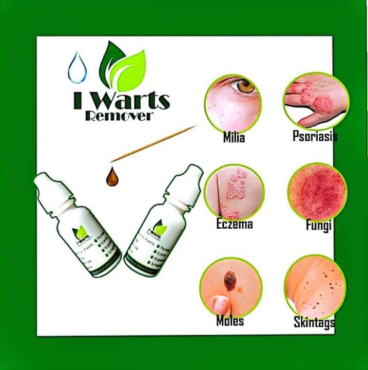 I WARTS Remover ORIGINAL Authentic for Warts Moles Skin Tags Nunal NOT ...