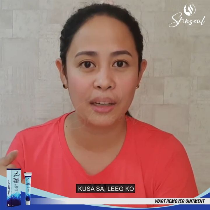 Skinsoul Wart Kulugo Remover Ointment - Skin tag & common Warts Fast ...