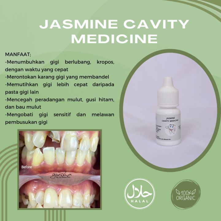 JASMINE CAVITY MEDICINE (Serum Penumbuh Gigi Alami, Gigi Ompong, Gigi ...
