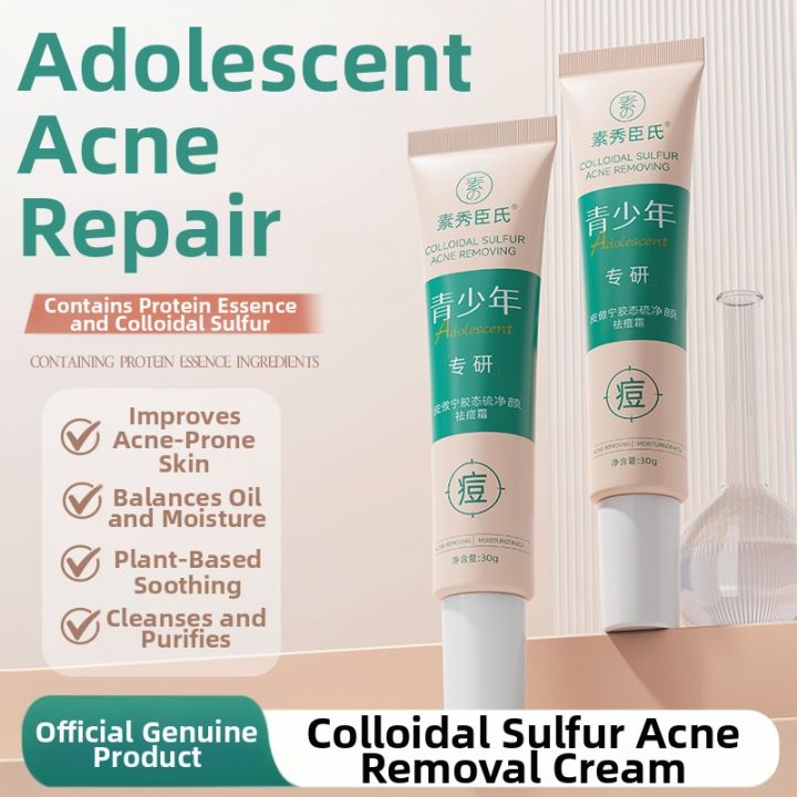 Acne Treatment Cream Pimple Mark Lightening Student Youthful Skin Care ...