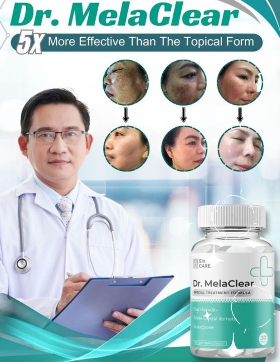 Dr Melaclear treatment for Melasma | Lazada PH