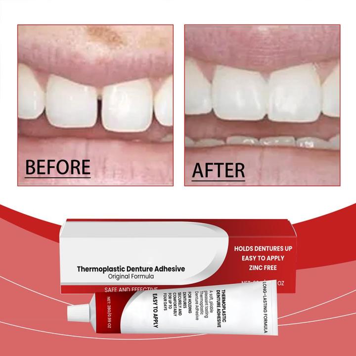 Comfort Denture Adhesives Glue Teeth Care Thermoplastic Denture ...