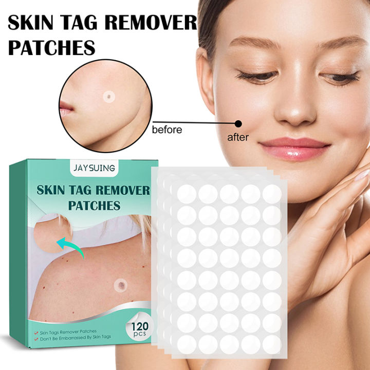 120pcs Skin Tag Remover Patches Foot Corn Plaster Acne Moles Warts ...