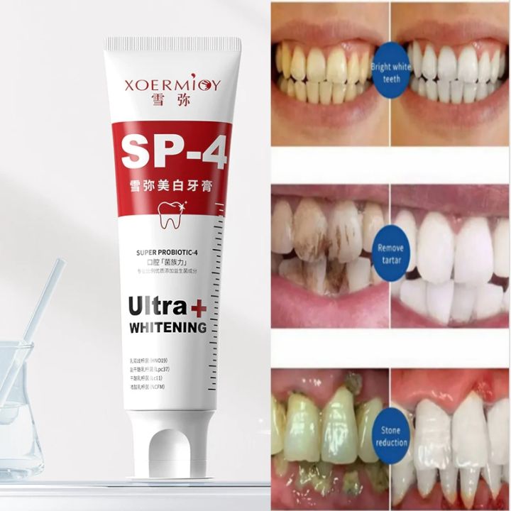 (100% Original Products)(100% Granted) Ubat gigi pemputih probiotik SP4 ...