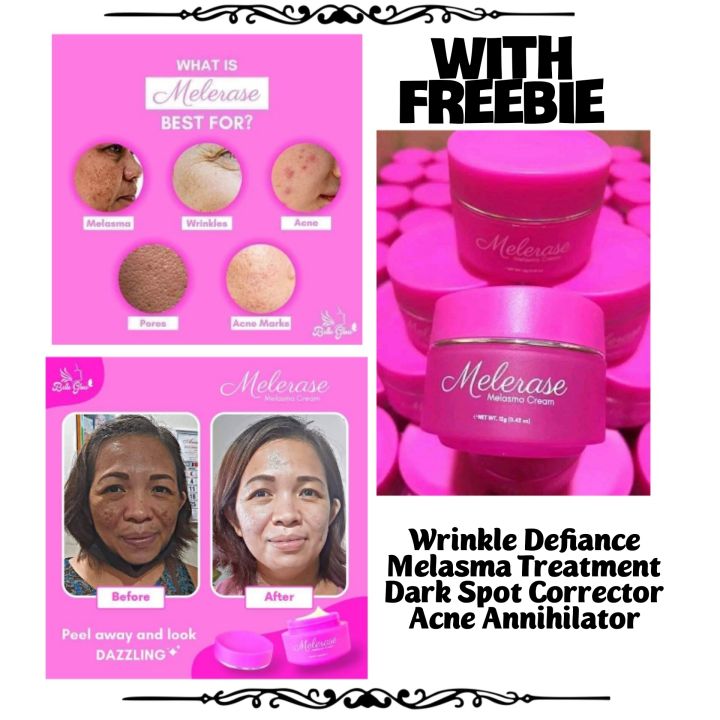 MELERASE Cream by Belle Glow |Pekas Melasma Dark Spots Remover Cream 12 ...