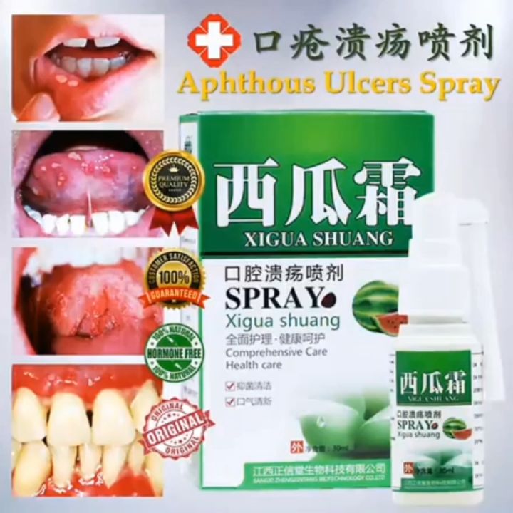 Oral ulcer spray mouth ulcers spray Ubat Semburan Ulser Mulut HFMD for ...