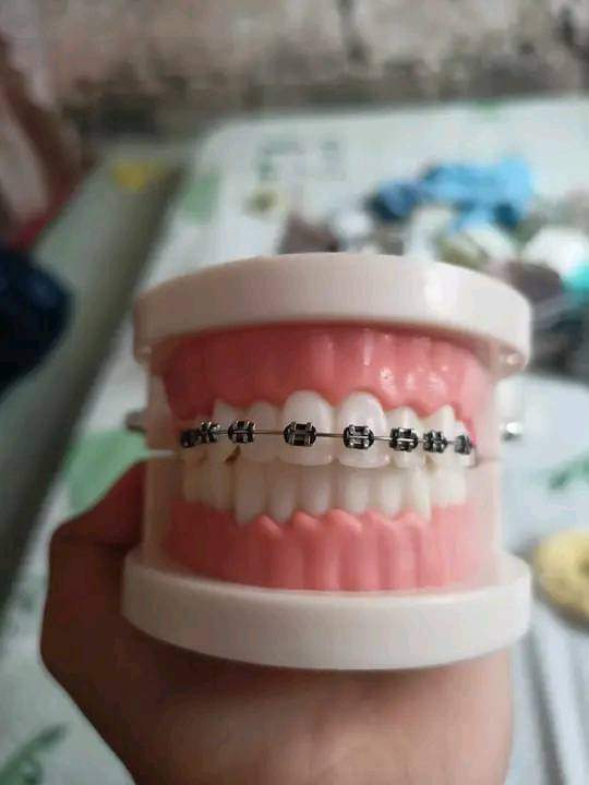 N8 up and down normal design | Lazada PH