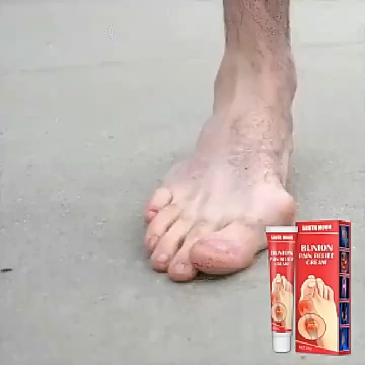 【Thailand Spot】Sumifun Heel Pain Bunion Pain Heel Pain Relief Cream ...