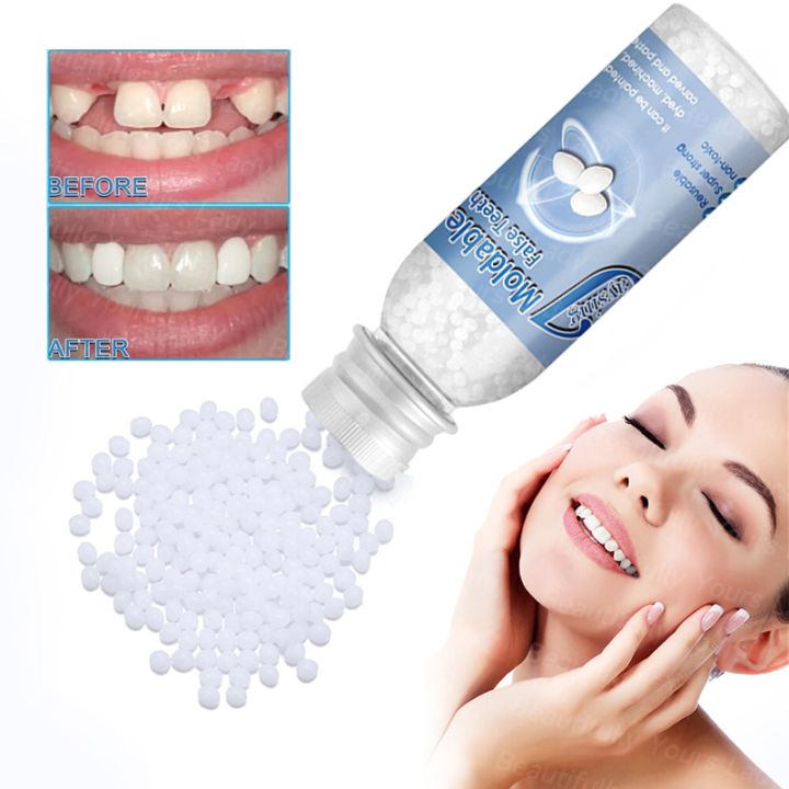 Temporary tooth repair teeth Set Solid Glue Tooth Filling Teeth And ...