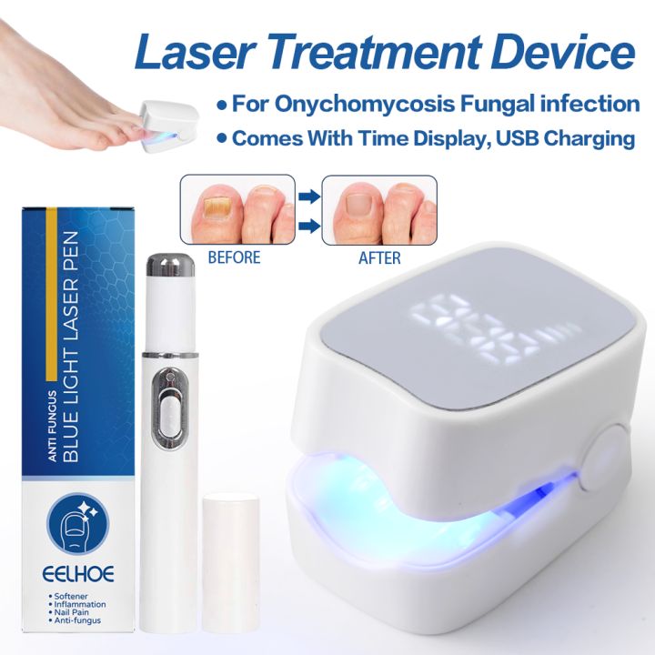 Nail Fungus Treatment Tools Fungal Nail Treatment Anti-Equipment ...