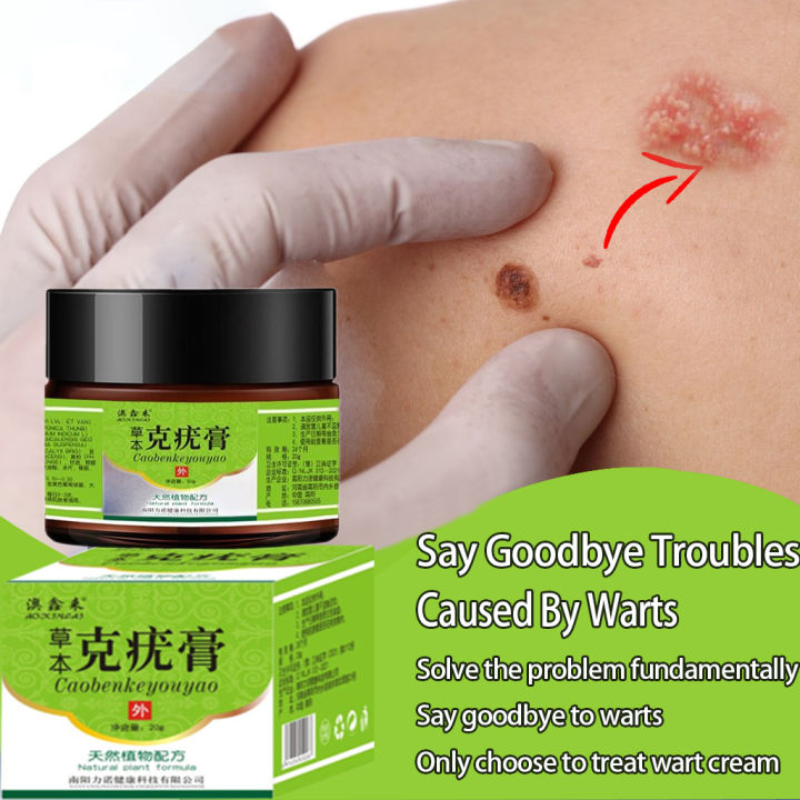 Warts Skin Tag Cream Warts cream 20g Wart Remover Ointment Wart ...