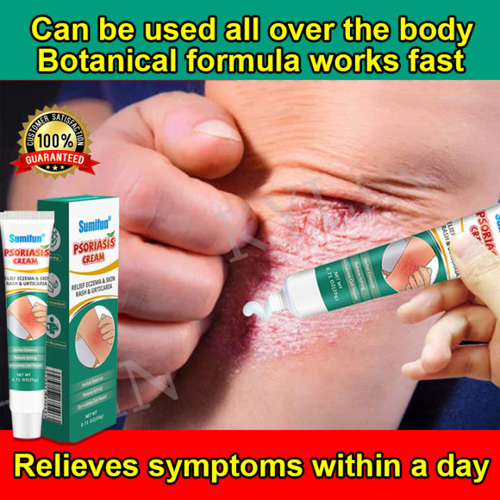 【Quick Itch Relief】Immediate Results! COD Sumifun Psoriasis Eczema ...
