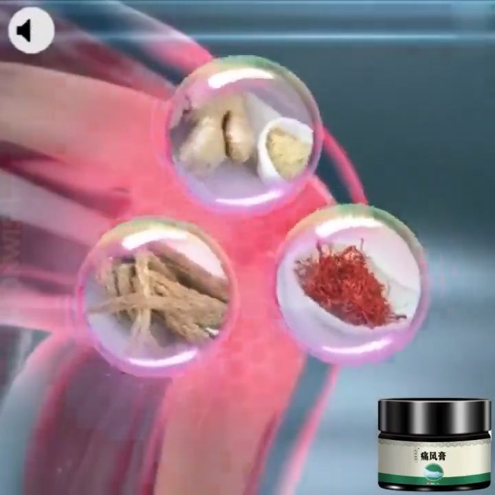 Gout Pain Relief Plaster Gout treatment cream 35g osteoarthritis joint ...