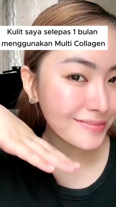 MULTI COLLAGEN 5X PREMIUM Collagen Supplement Beauty Whitening Anti ...