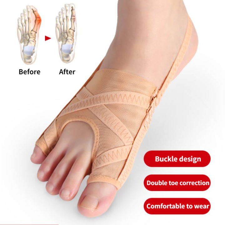 Hallux valgus little toe varus toe orthosis toe separation orthosis toe ...