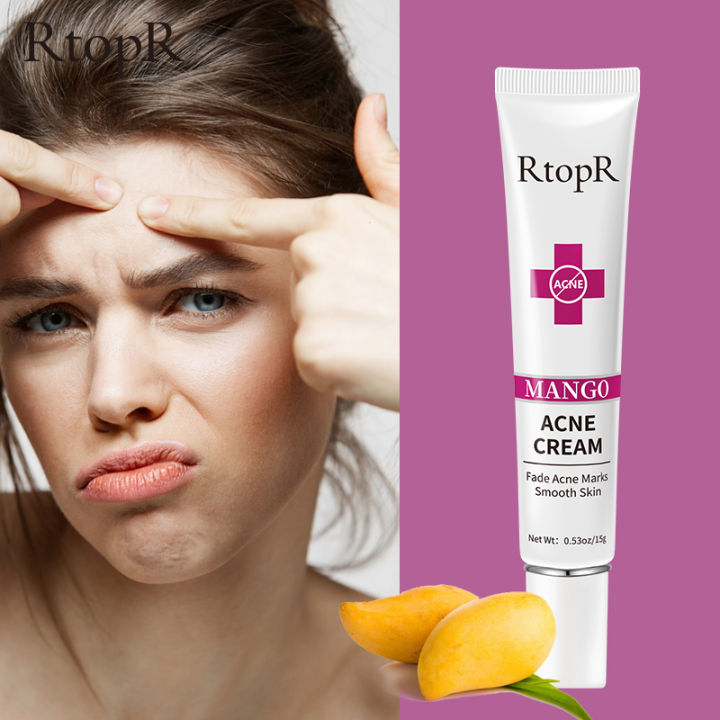 RtopR Mango Acne Treatment Cream Blackhead Repair Gel Serum Control ...