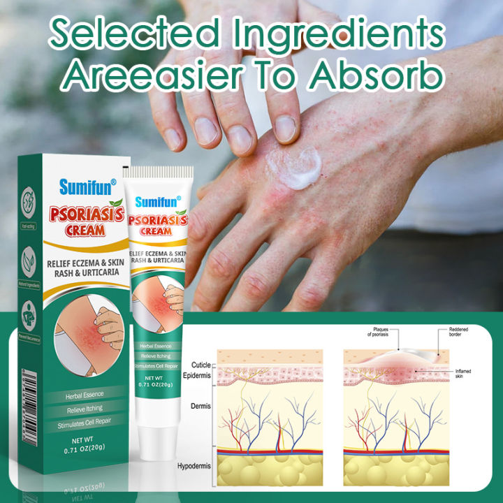 Sumifun dermatitis cream Psoriasis Eczema Cream Ointment treatment Cream Antibacterial Cream ...