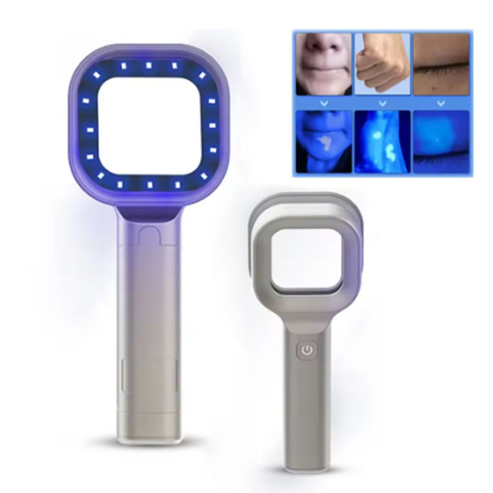 Woods Light Skin Examination For Cat Dog Ringworm Handheld UV Wood's ...