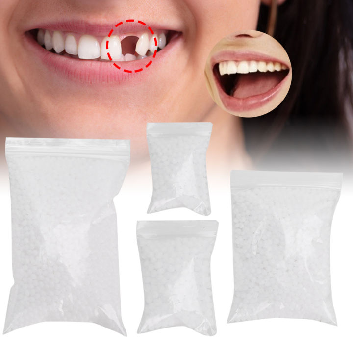 Tooth Repair Bead Broken Teeth Repair Temporary Tooth Repair Beads for ...