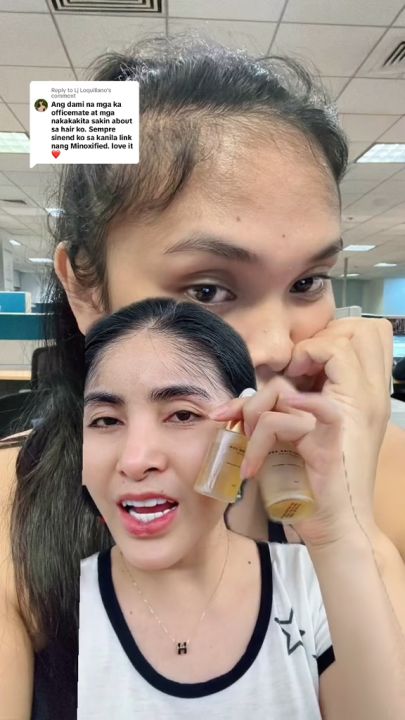 Minoxified 20% - hair grower made in thailand | Lazada PH