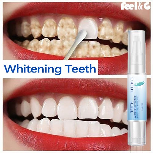 Teeth Whitening Pen Yellow Teeth Cavities Plaque Elimination Instant ...