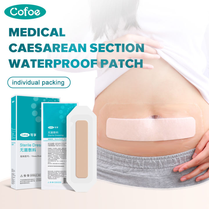 Cofoe Medical Sterile Waterproof Wound Dressing Patch Caesarean ...