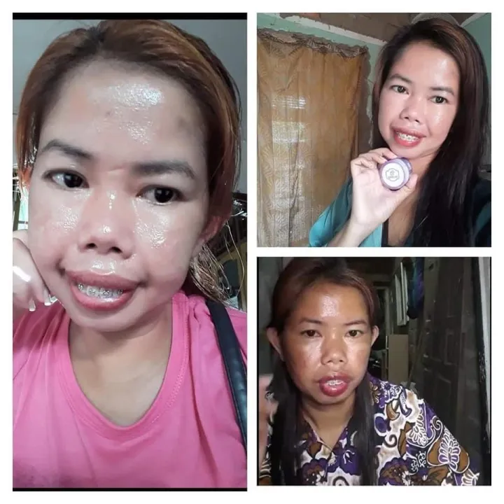 UBC SKIN | Lazada