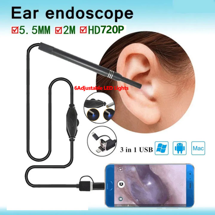 Visual Earpick With Camera HD Otoscope Ear Wax Removal Kit, USB Ear ...