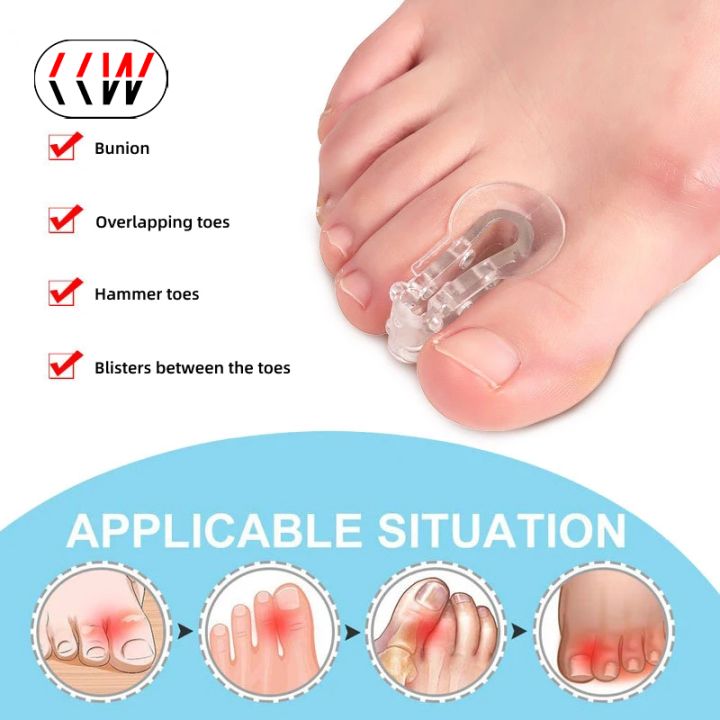 CCW 1 Pair Gel Toe Corrector Big Toe Separator Hallux Valgus Bunion ...