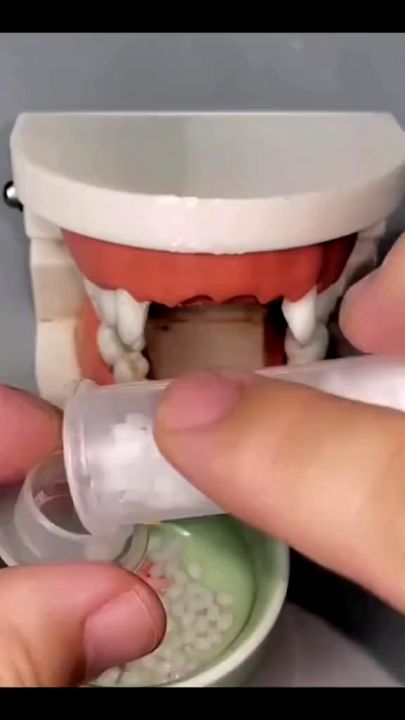 Moldable False Teeth Temporary Tooth Repair Kit Teeth and Gaps Moldable ...